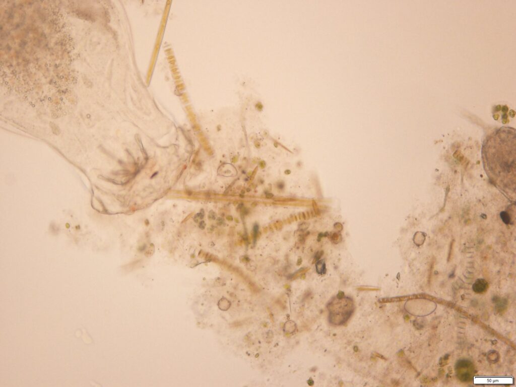 Biofloc Technology in Aquaculture: Enhancing Sustainability and ...